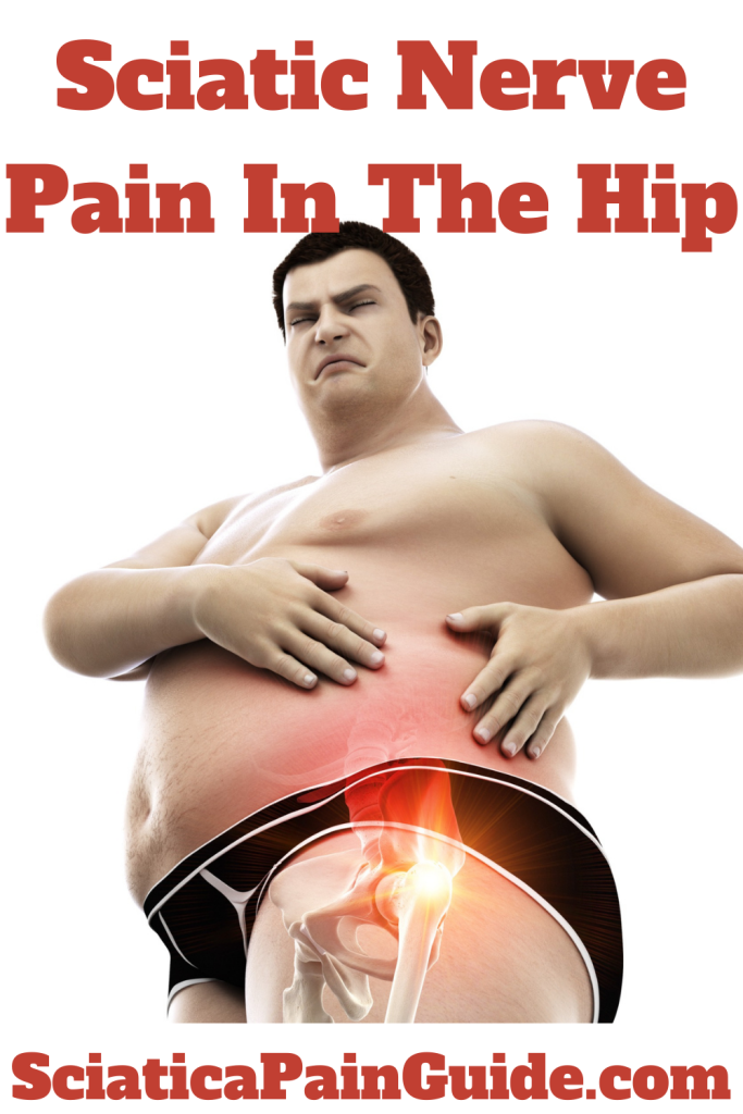 Sciatic Nerve Pain In The Hip - Sciatica Pain Guide