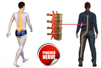 Foot Sciatic Nerve Trigger Points - Sciatica Pain Guide