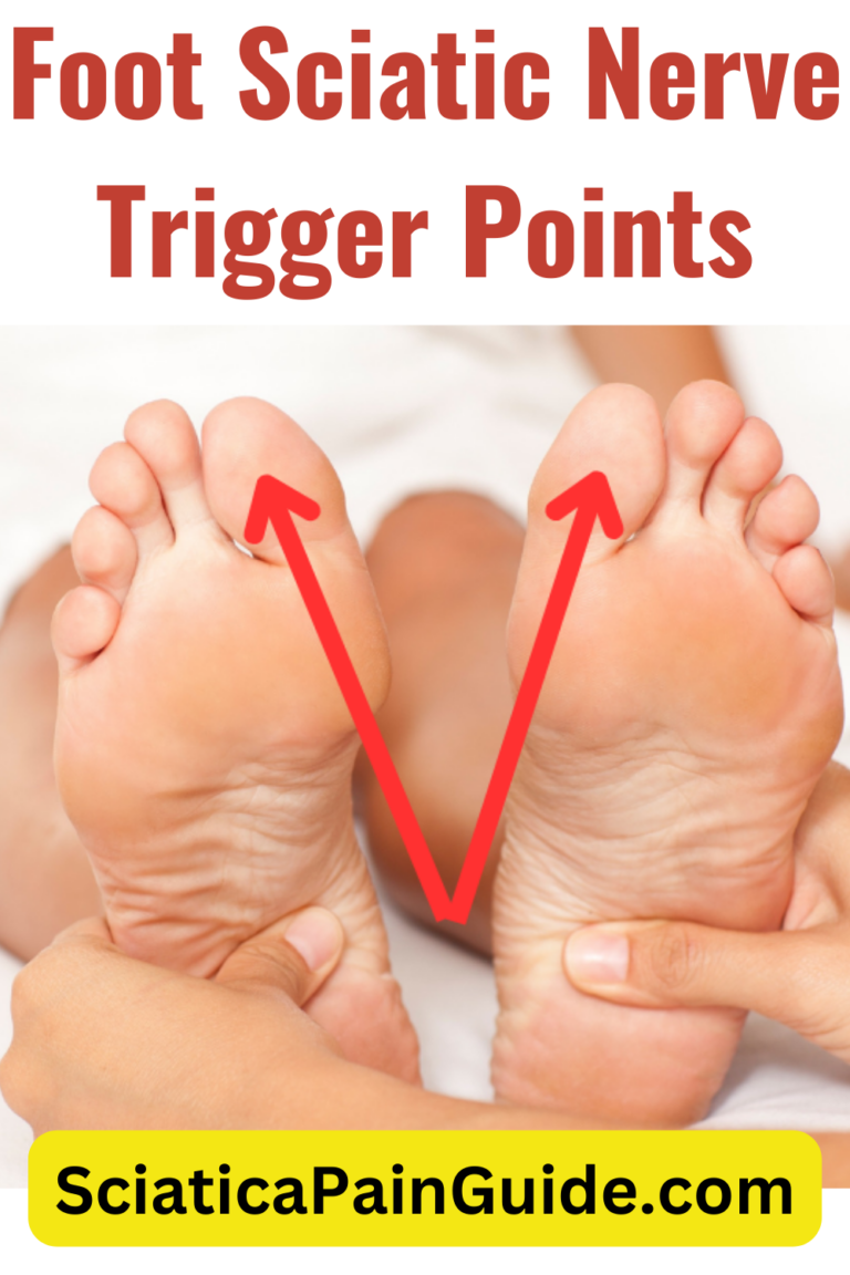 Foot Sciatic Nerve Trigger Points - Sciatica Pain Guide