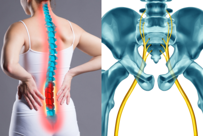 Sciatic Nerve Pain In The Hip - Sciatica Pain Guide
